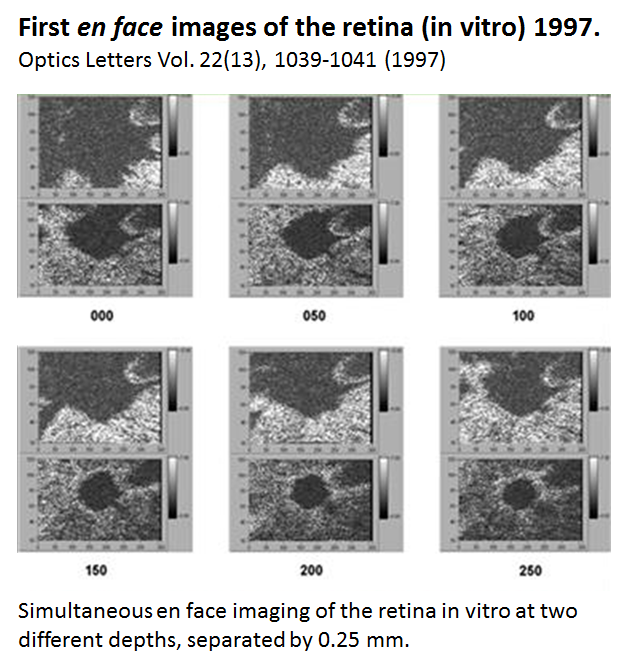 First en face OCT of the retina - Applied Optics Group - Research at Kent